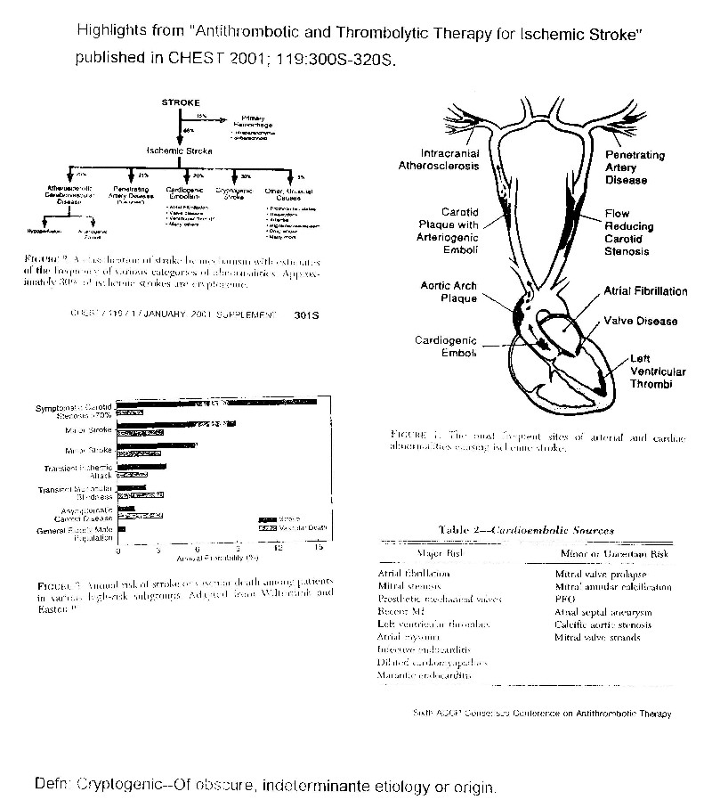 Stress Testing 2002 | Stroke Highlights